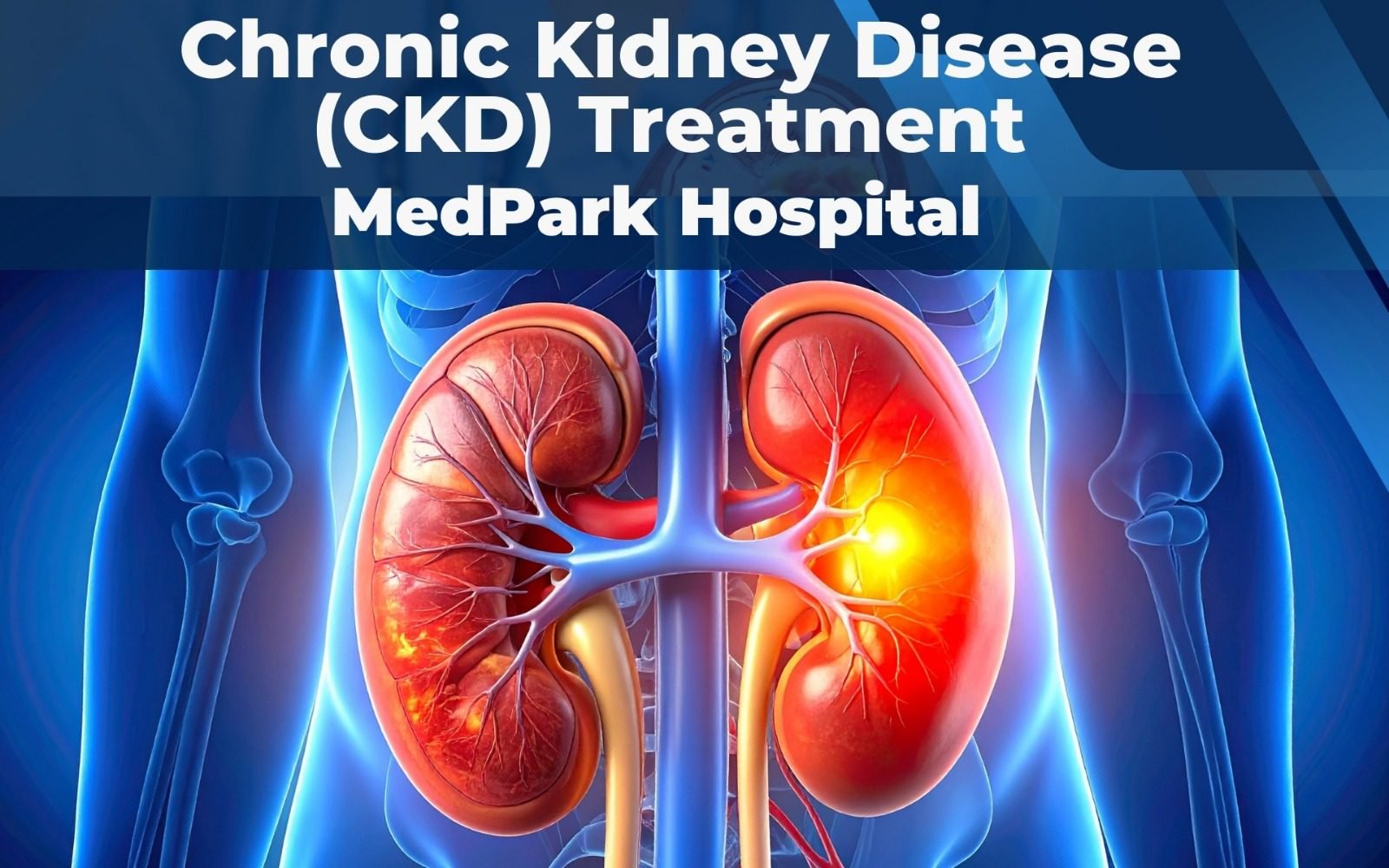 Chronic Kidney Disease (CKD) Treatment Mohali and Chandigarh